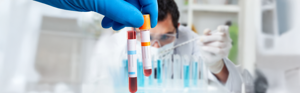 Functional Pathology Testing in Adelaide - Discover Root Causes for ...